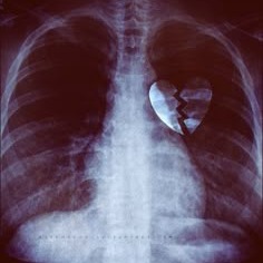 Broken Heart Pfps and Icons - For Discord, Instagram & TikTok